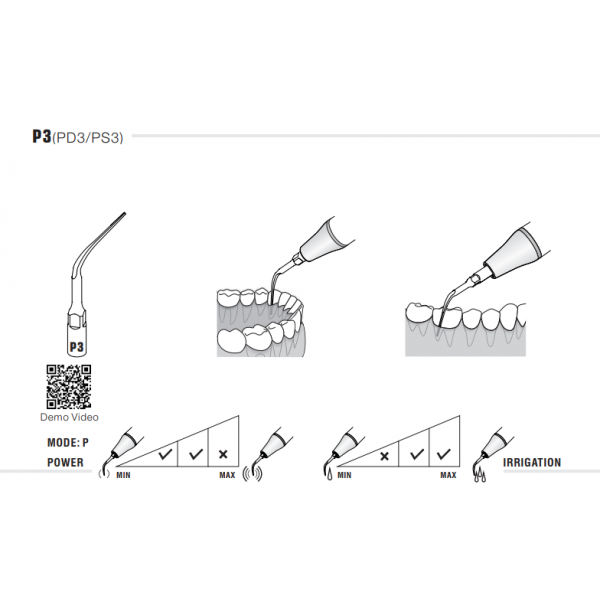 Insert ultrasonique type EMS modèle P3 PD3 PS3 Woodpecker Prophylaxie